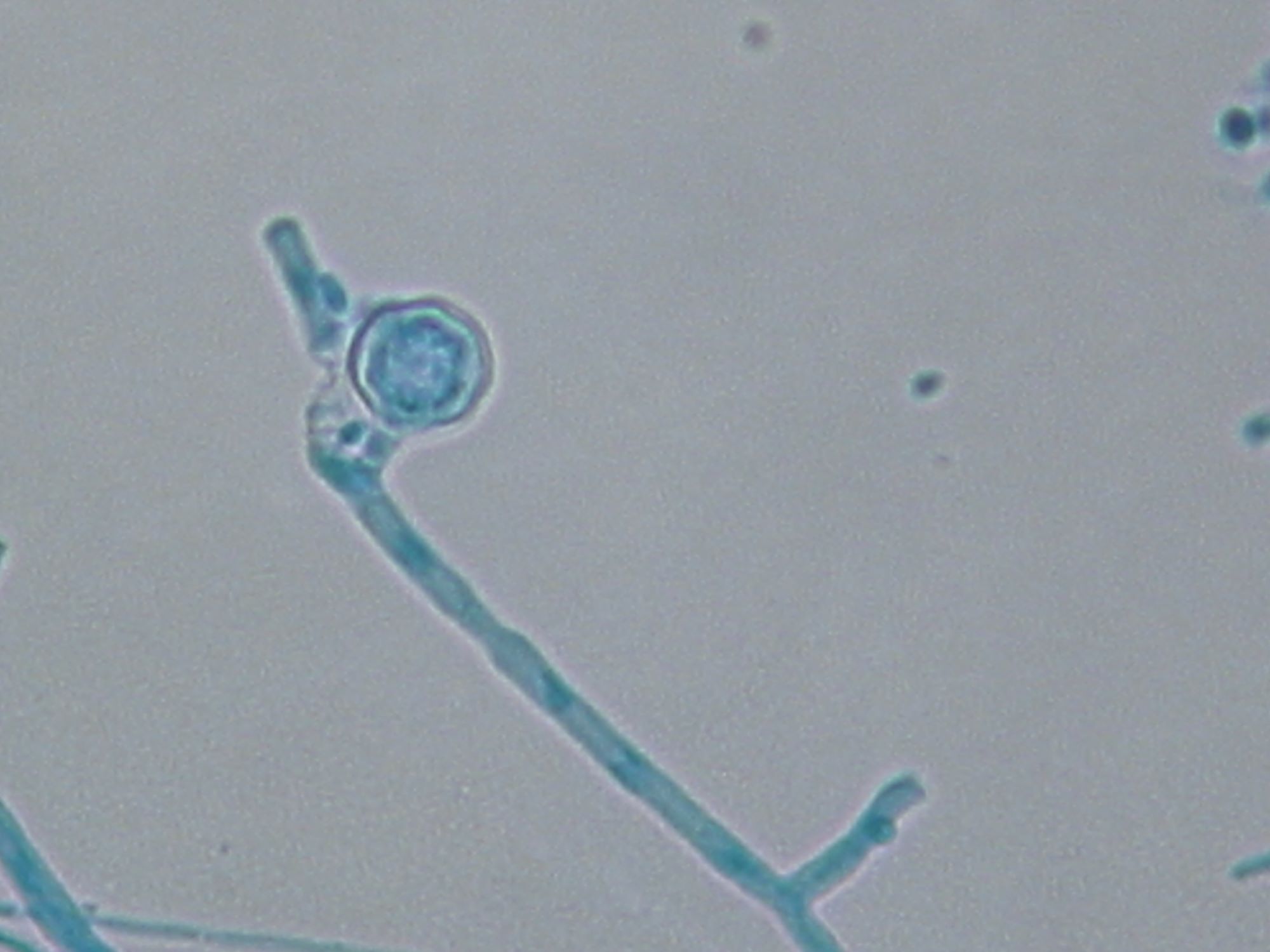 LABOPART - Trichophyton interdigitale