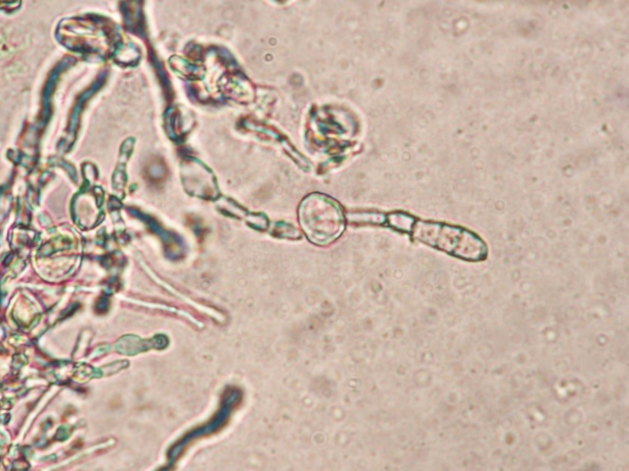 LABOPART - Epidermophyton floccosum
