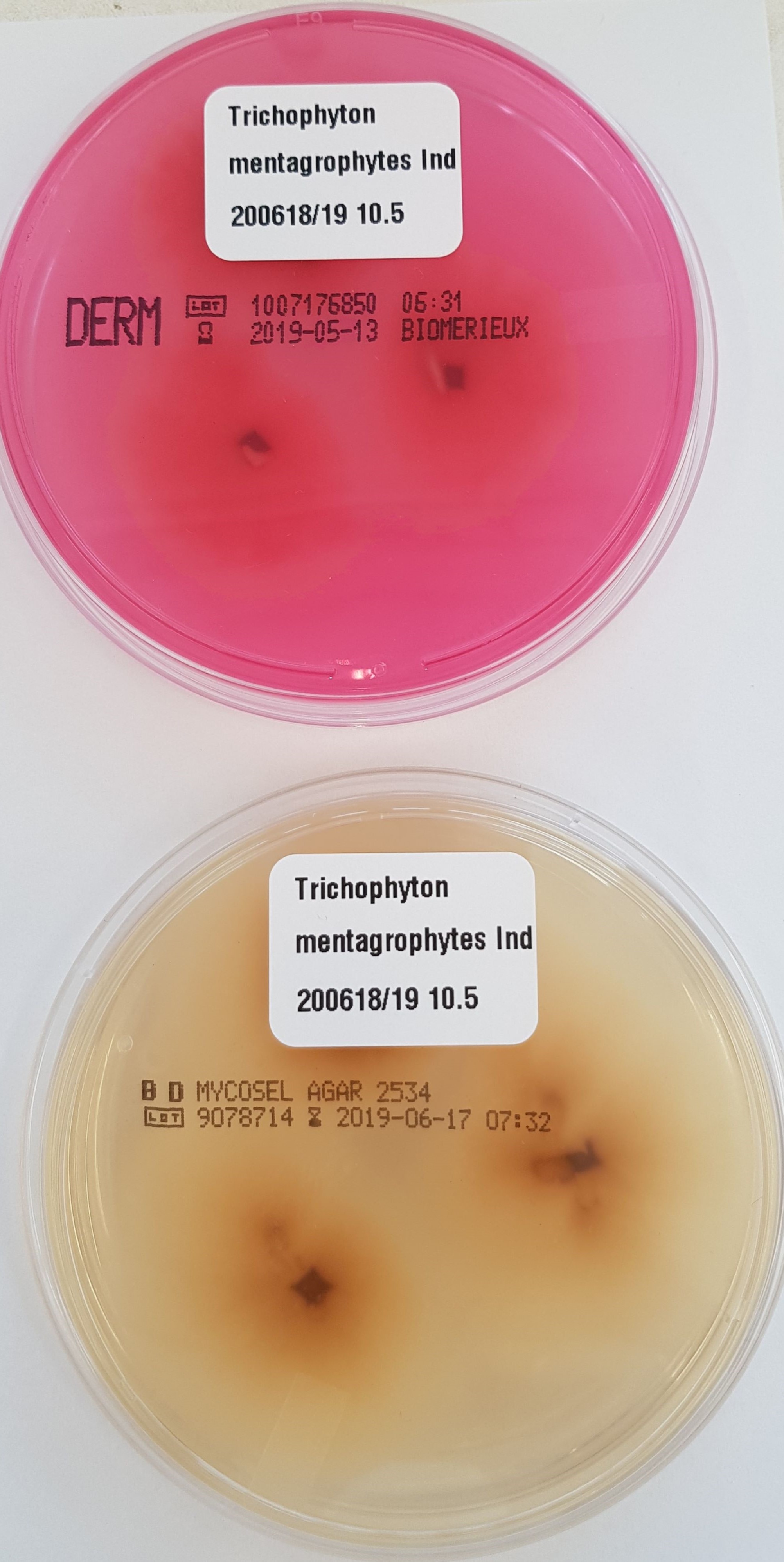 LABOPART - Trichophyton indotineae