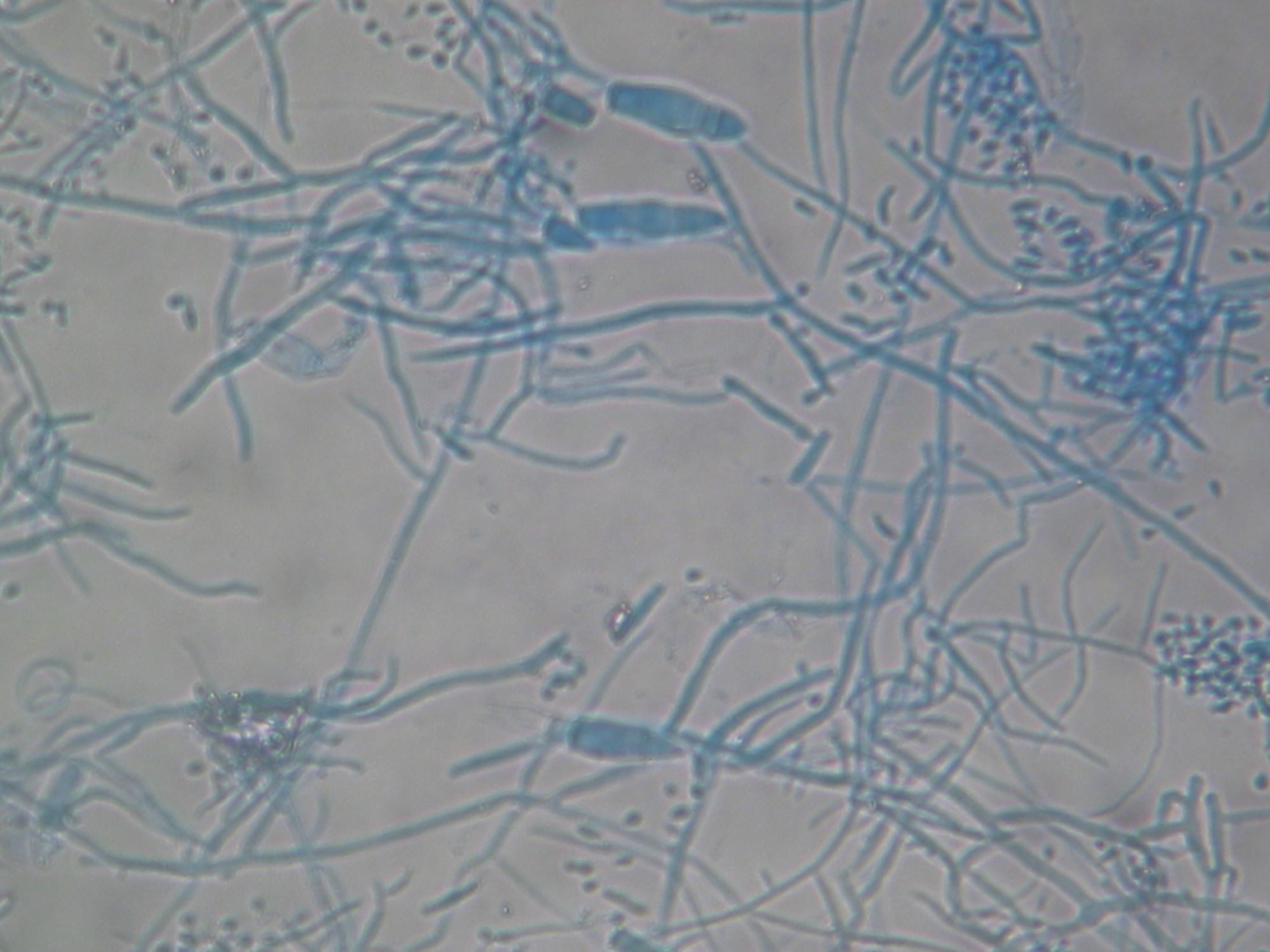 LABOPART - Trichophyton interdigitale