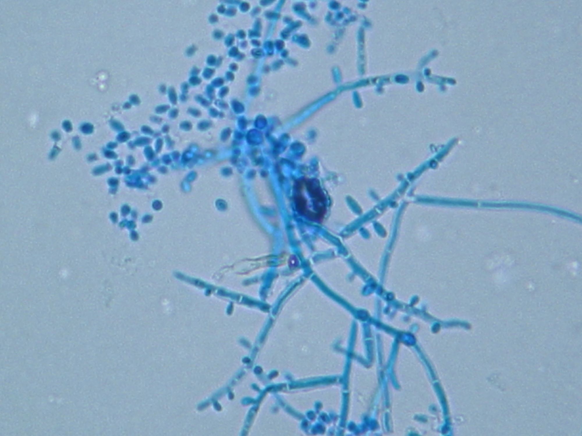 LABOPART - Trichophyton equinum