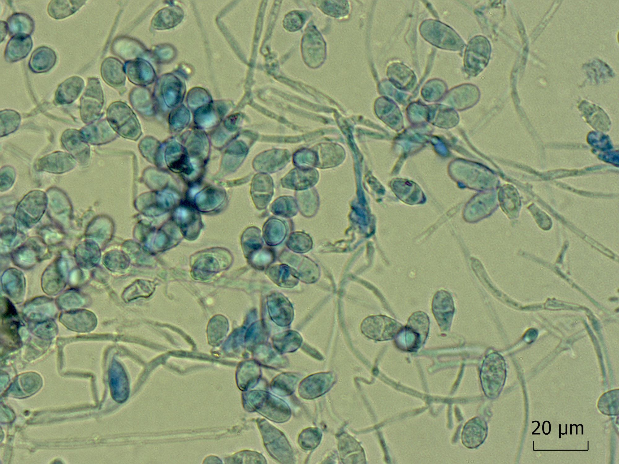 LABOPART - Nannizzia nana