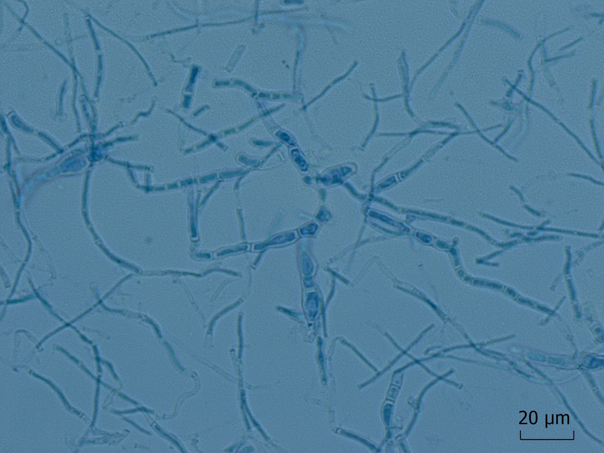 LABOPART - Nannizzia perplicata