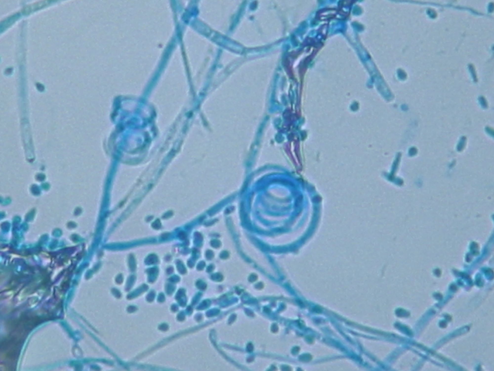 LABOPART - Trichophyton interdigitale