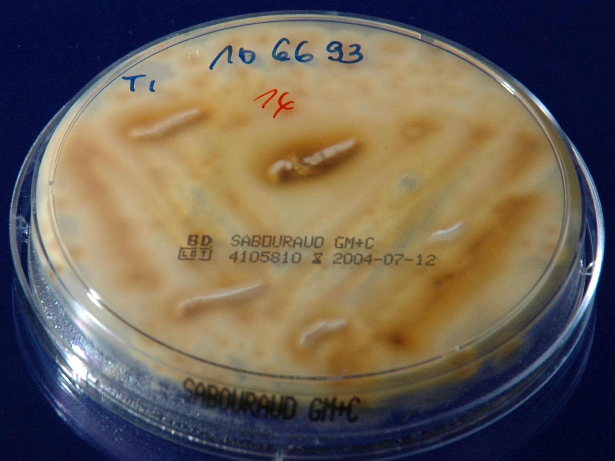 LABOPART - Trichophyton interdigitale