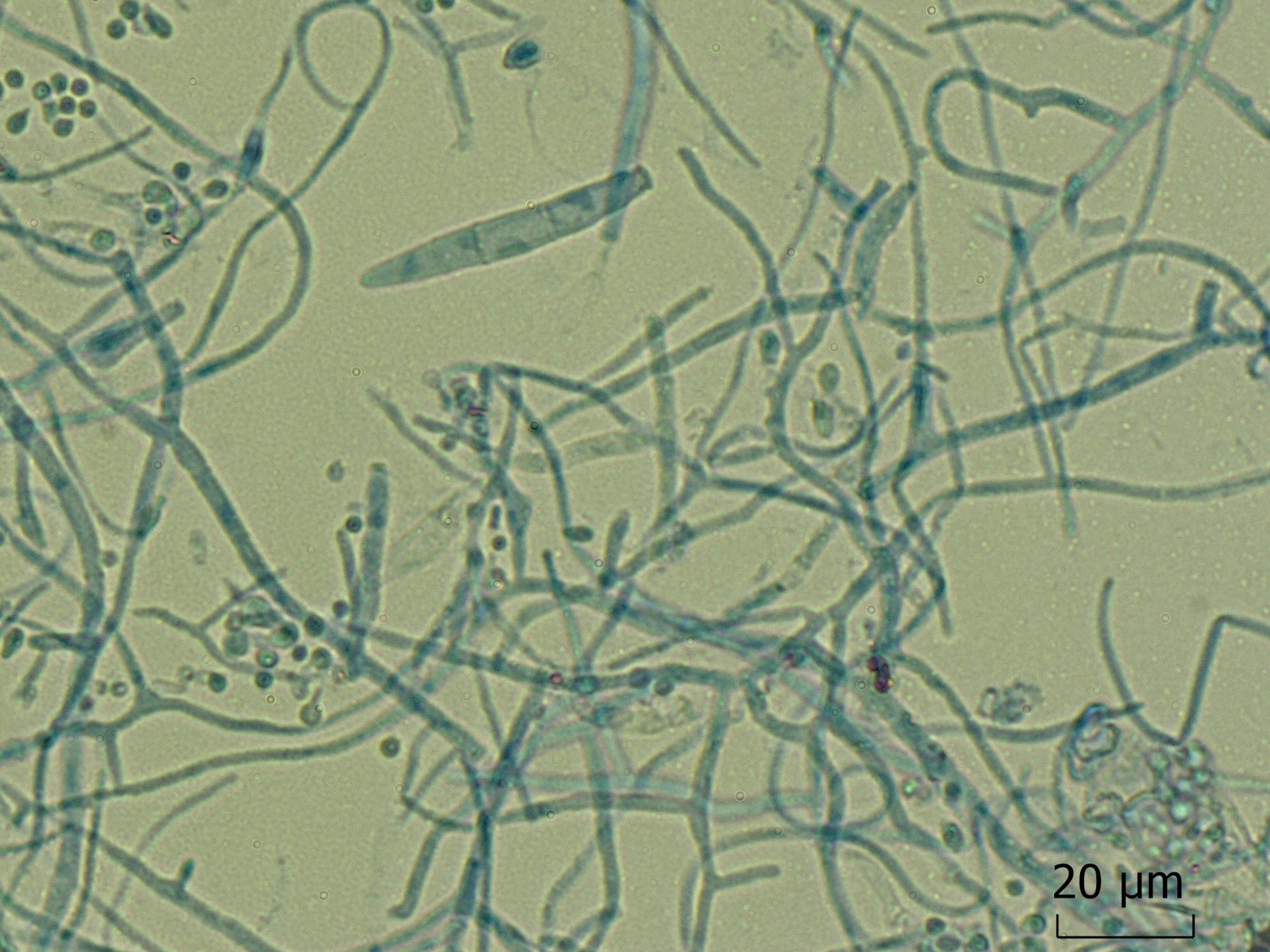 LABOPART - Trichophyton indotineae