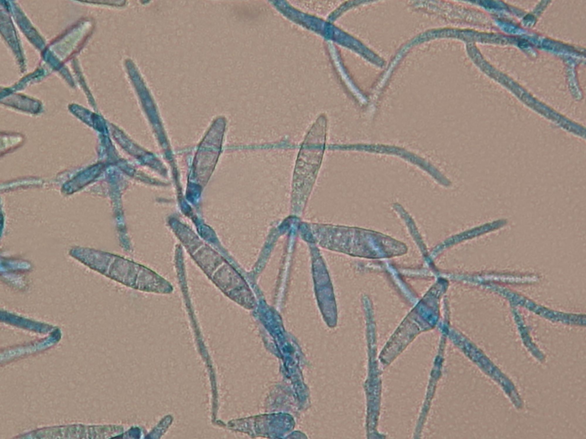 LABOPART - Nannizzia praecox
