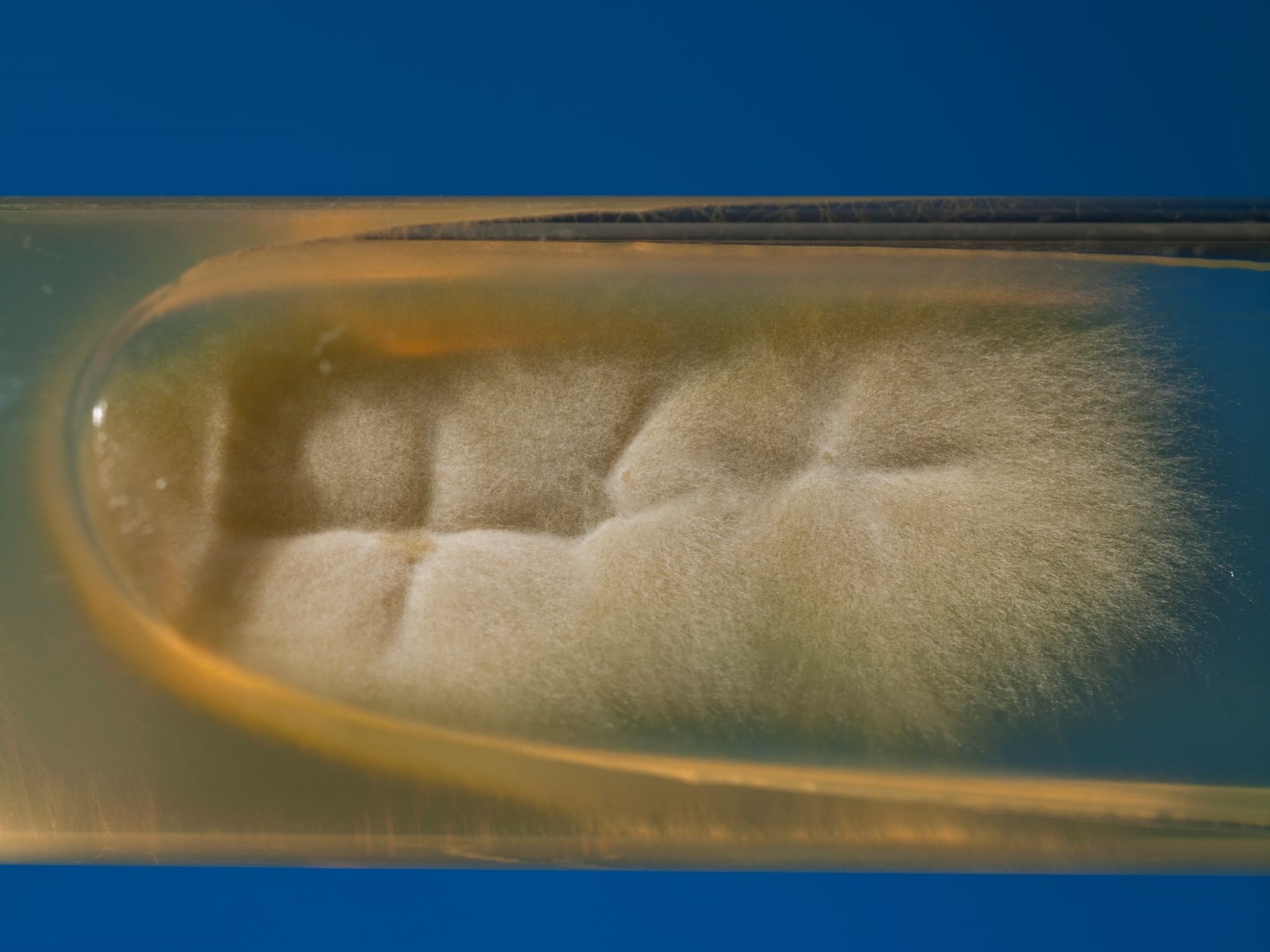 LABOPART - Trichophyton benhamiae