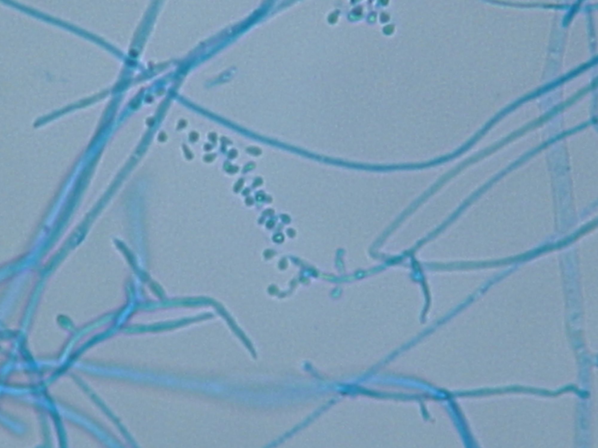 LABOPART - Trichophyton interdigitale