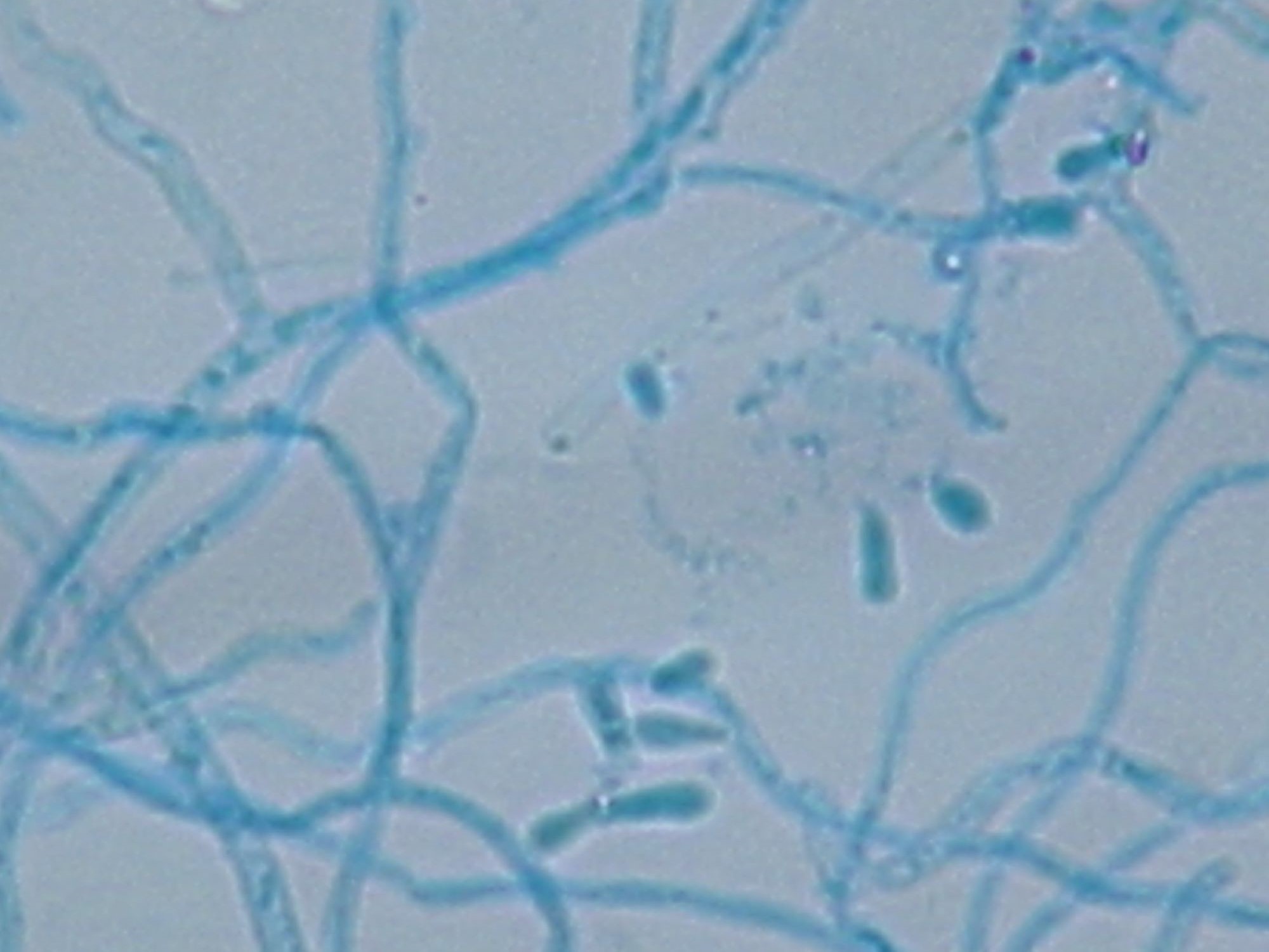 LABOPART - Microsporum audouinii