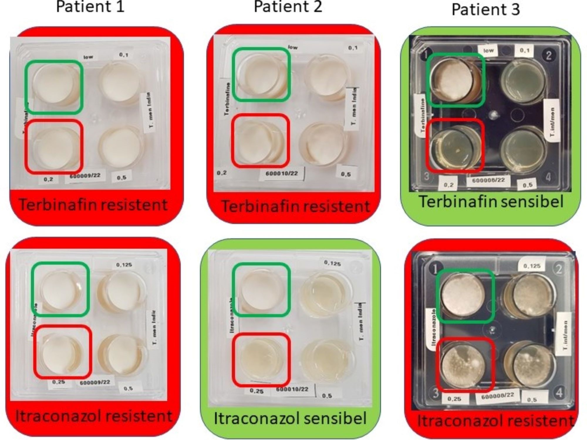 LABOPART - Trichophyton indotineae