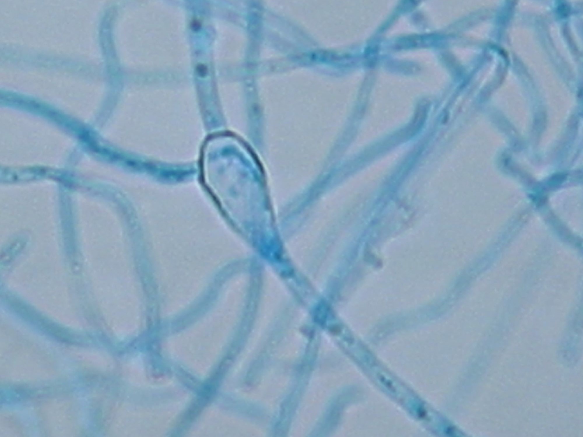 LABOPART - Microsporum audouinii