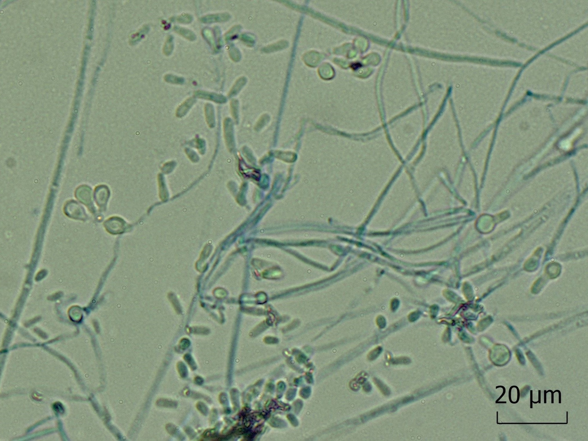 LABOPART - Arthroderma quadrifidum