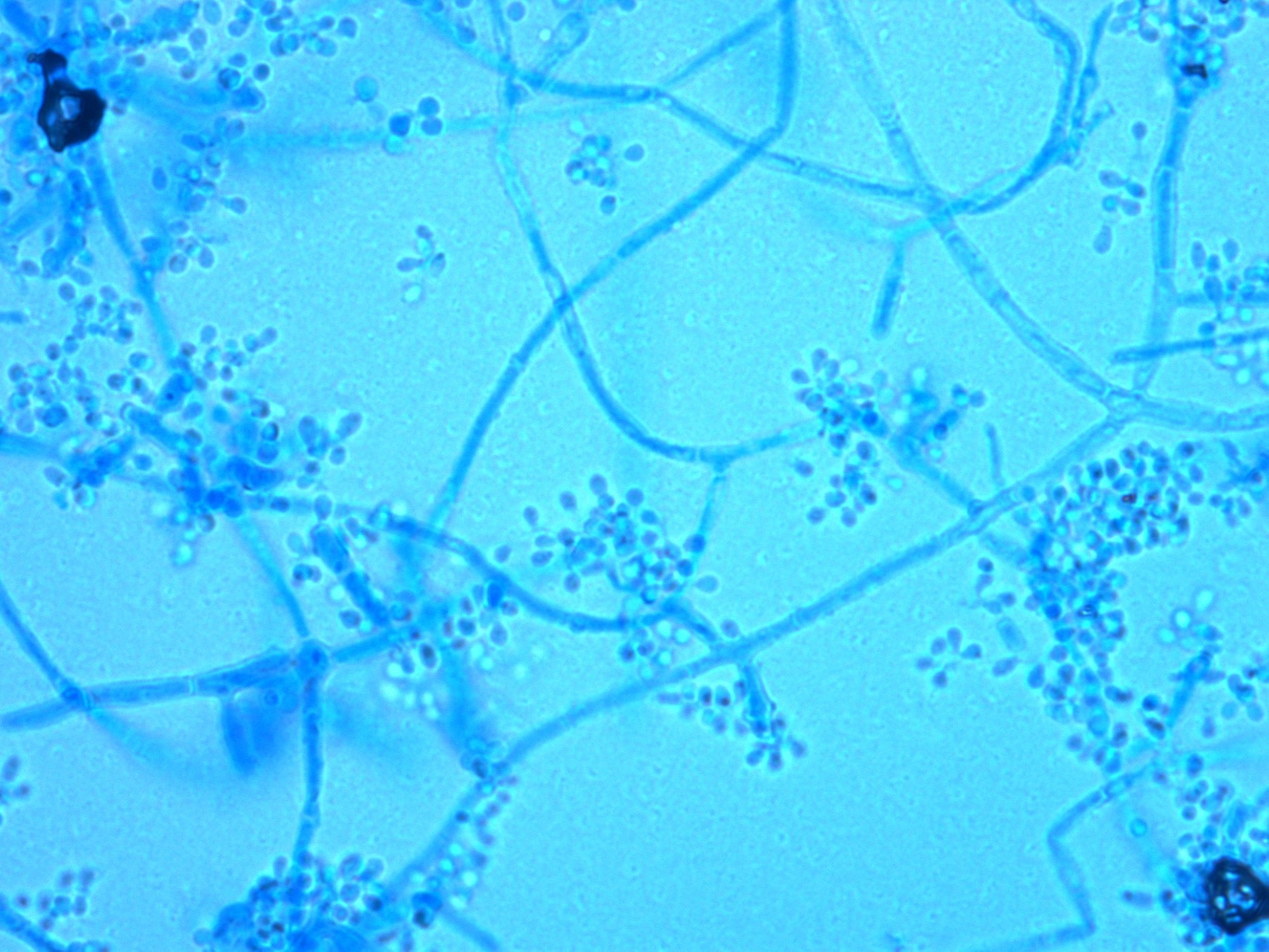 LABOPART - Trichophyton benhamiae