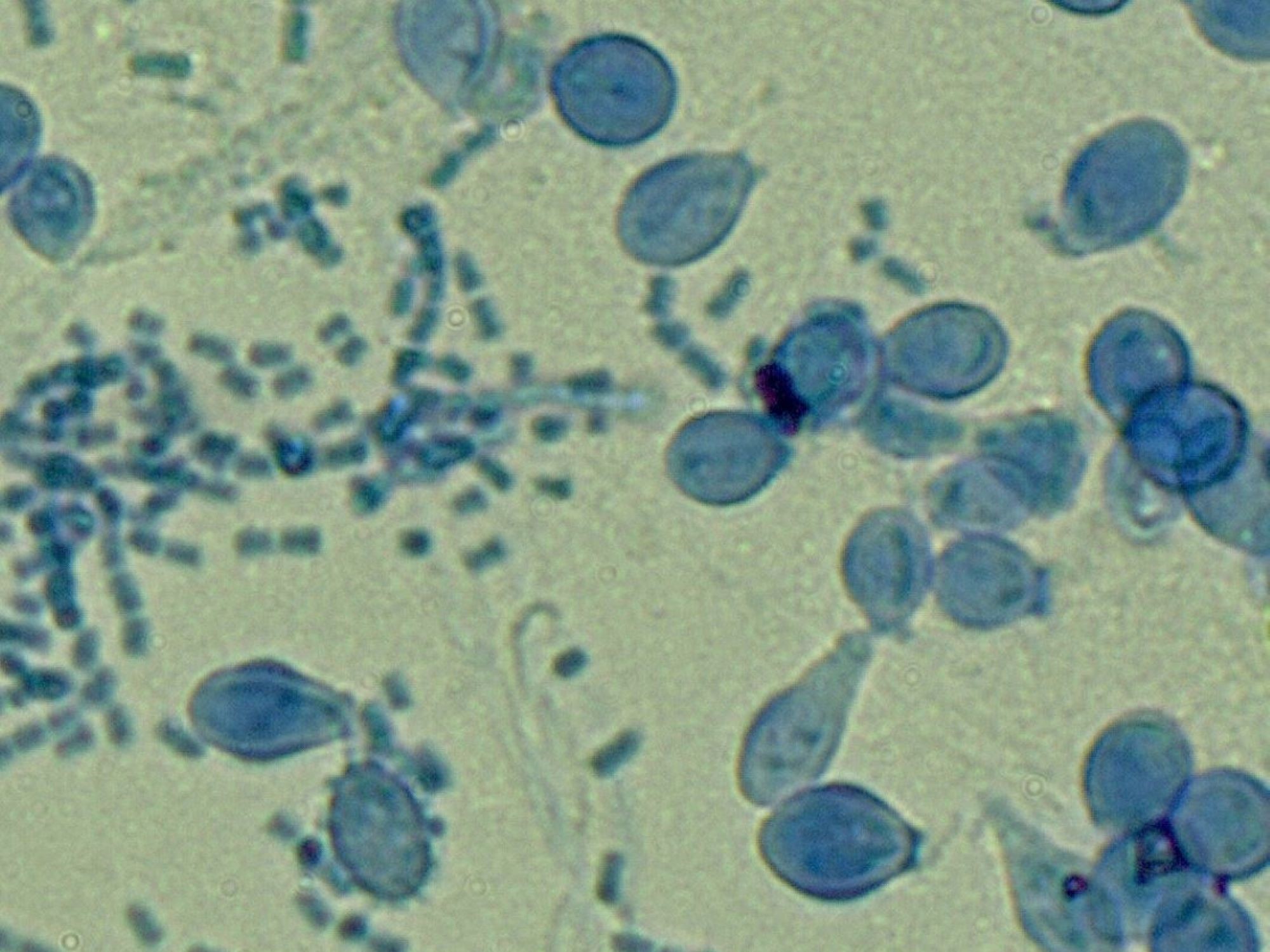 LABOPART - Arthroderma tuberculatum