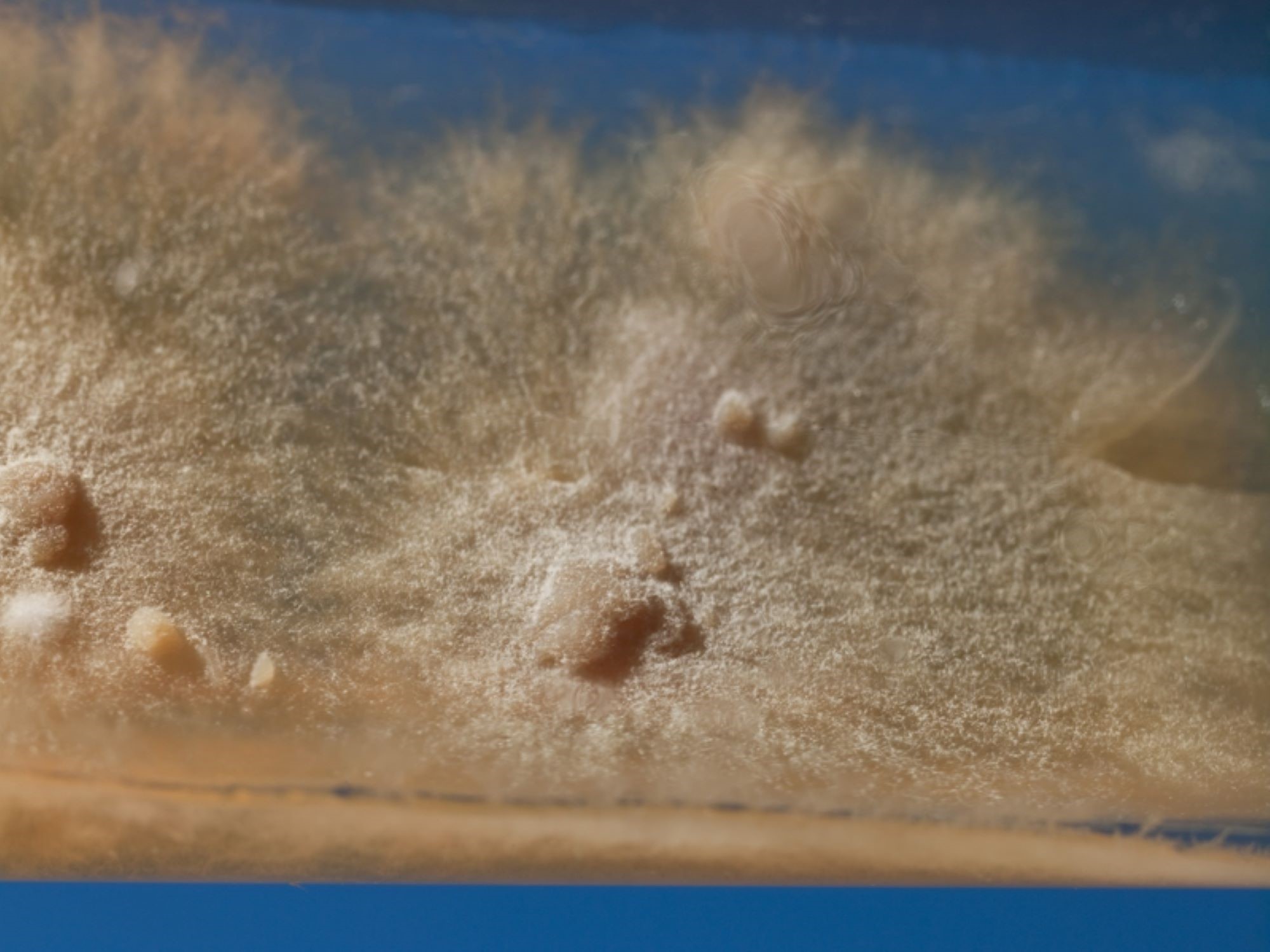 LABOPART - Epidermophyton floccosum