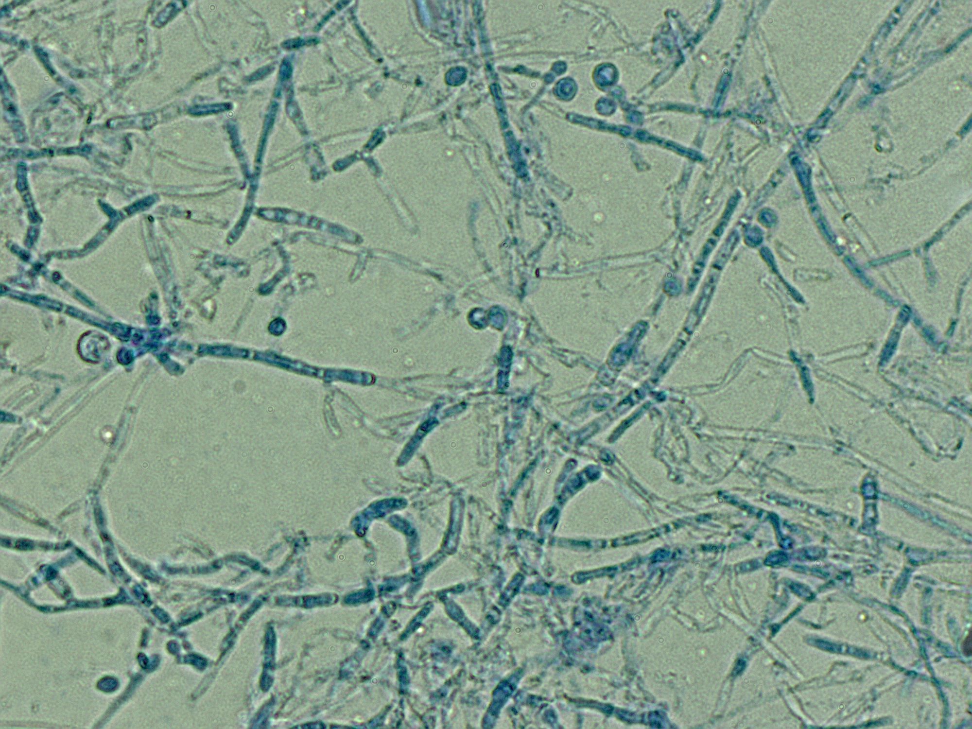 LABOPART - Arthroderma onychocola