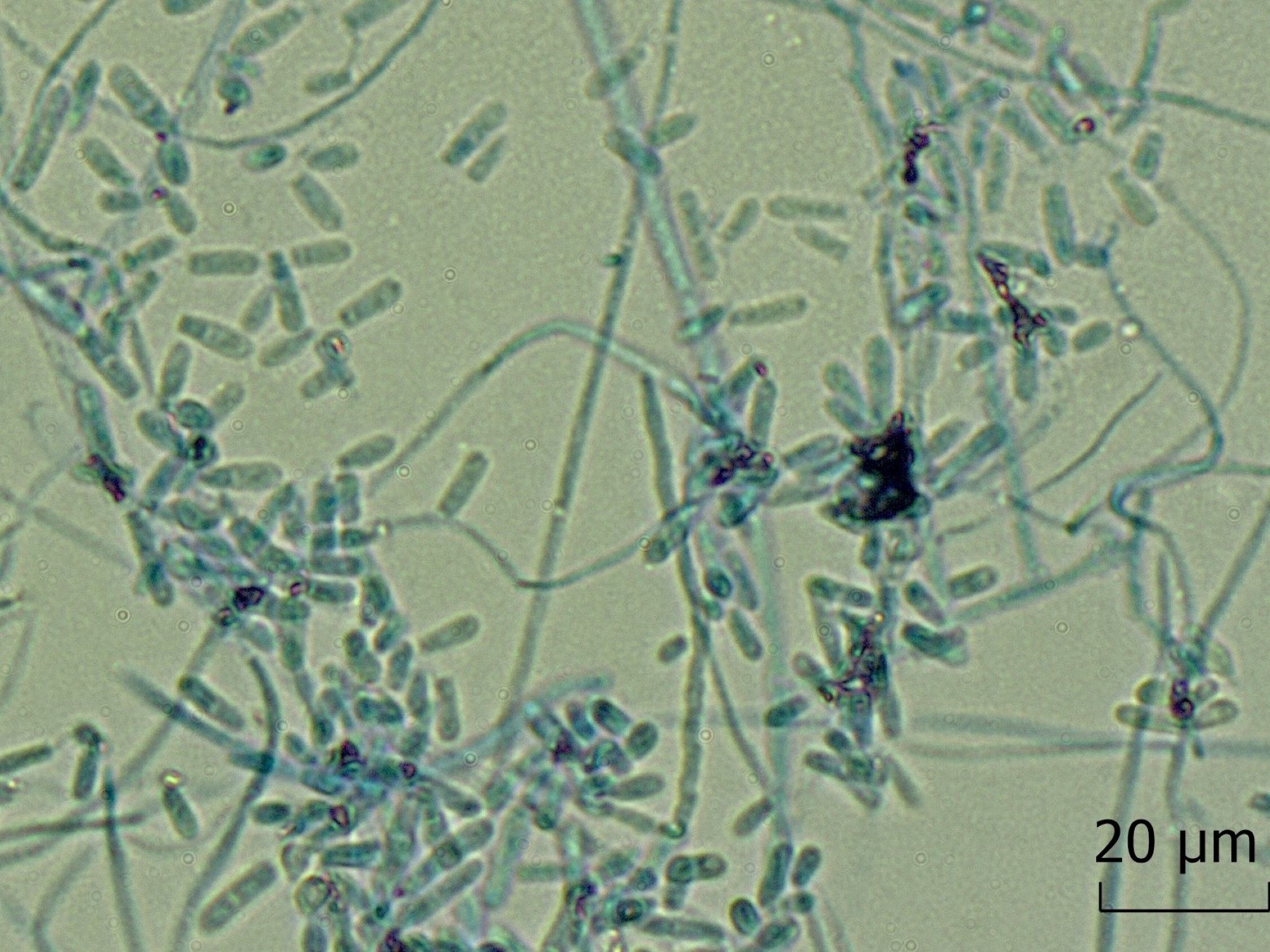 LABOPART - Arthroderma quadrifidum