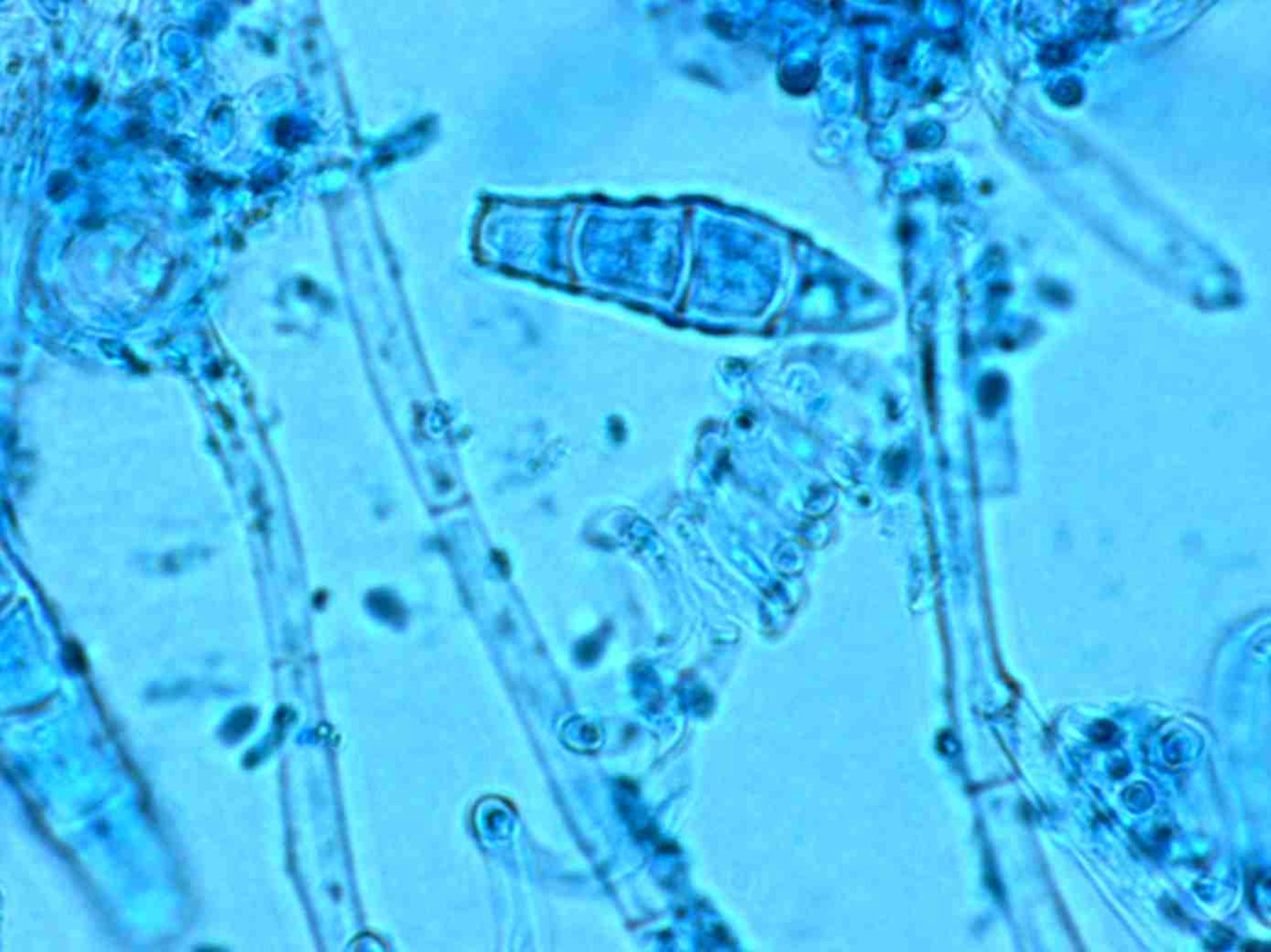 LABOPART - Nannizzia persicolor