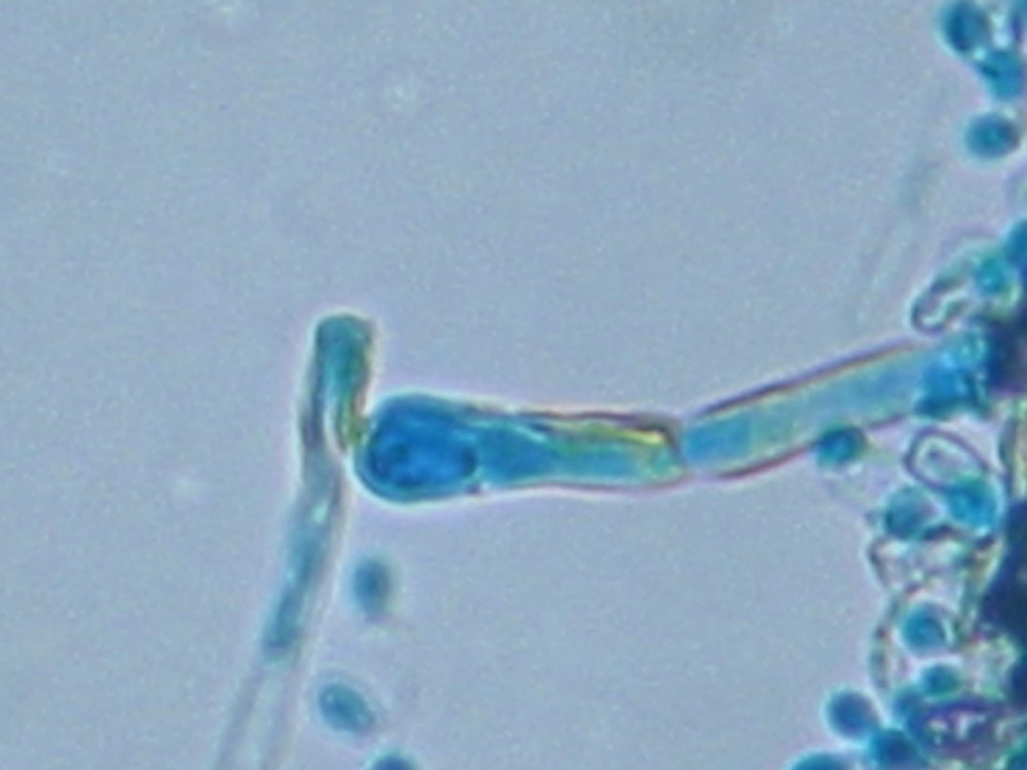 LABOPART - Trichophyton equinum