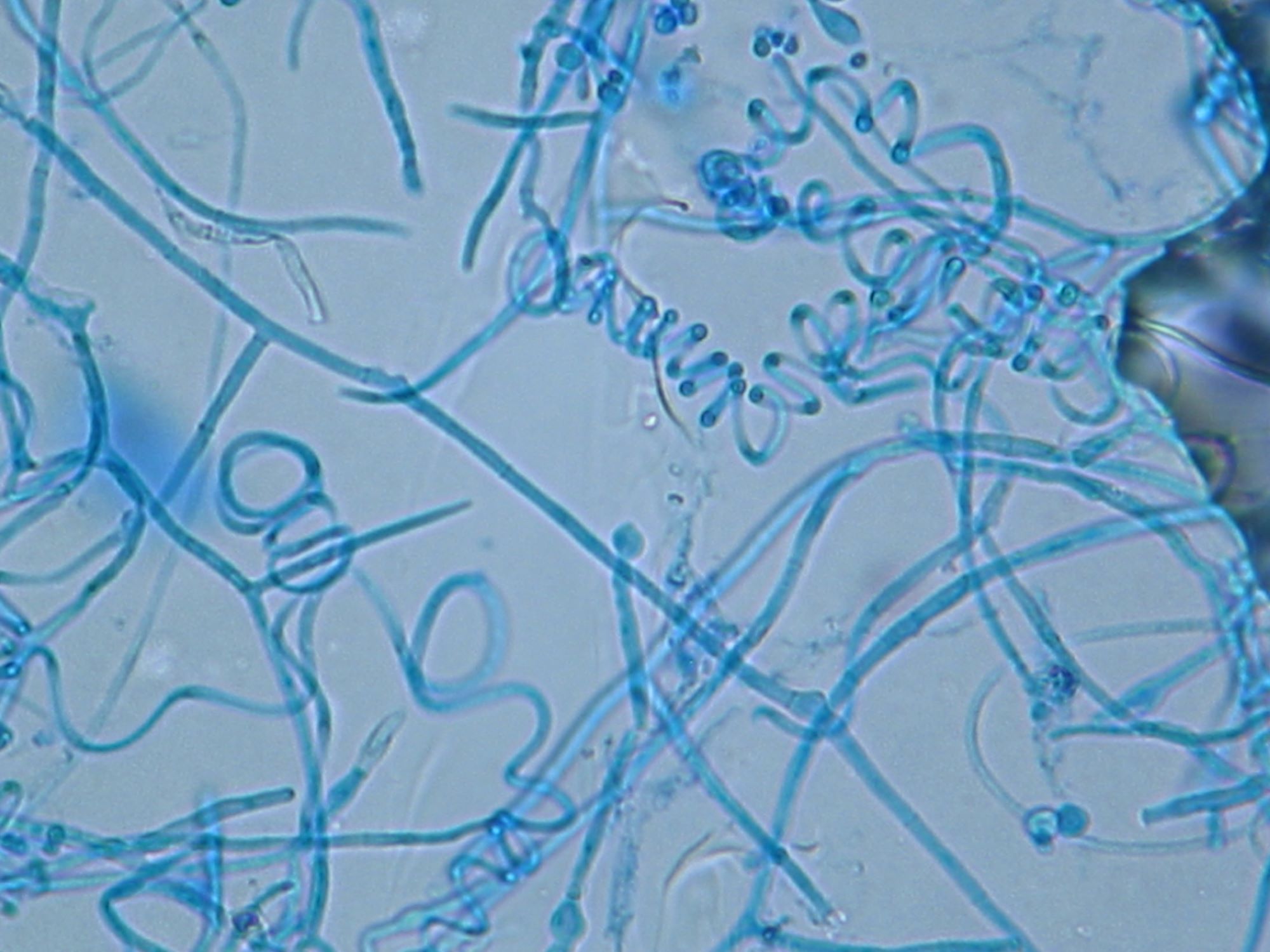 LABOPART - Trichophyton indotineae