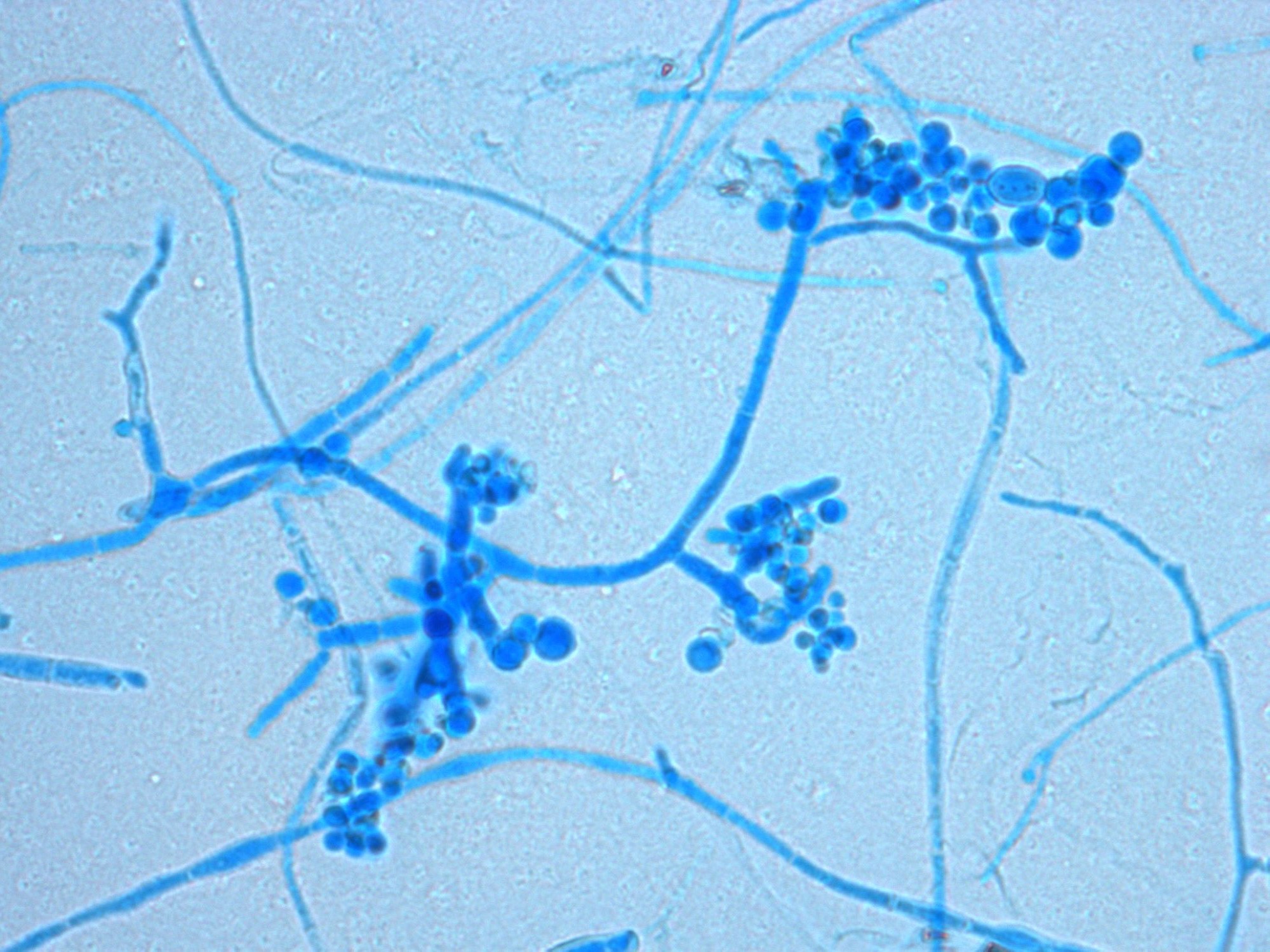 LABOPART - Trichophyton benhamiae