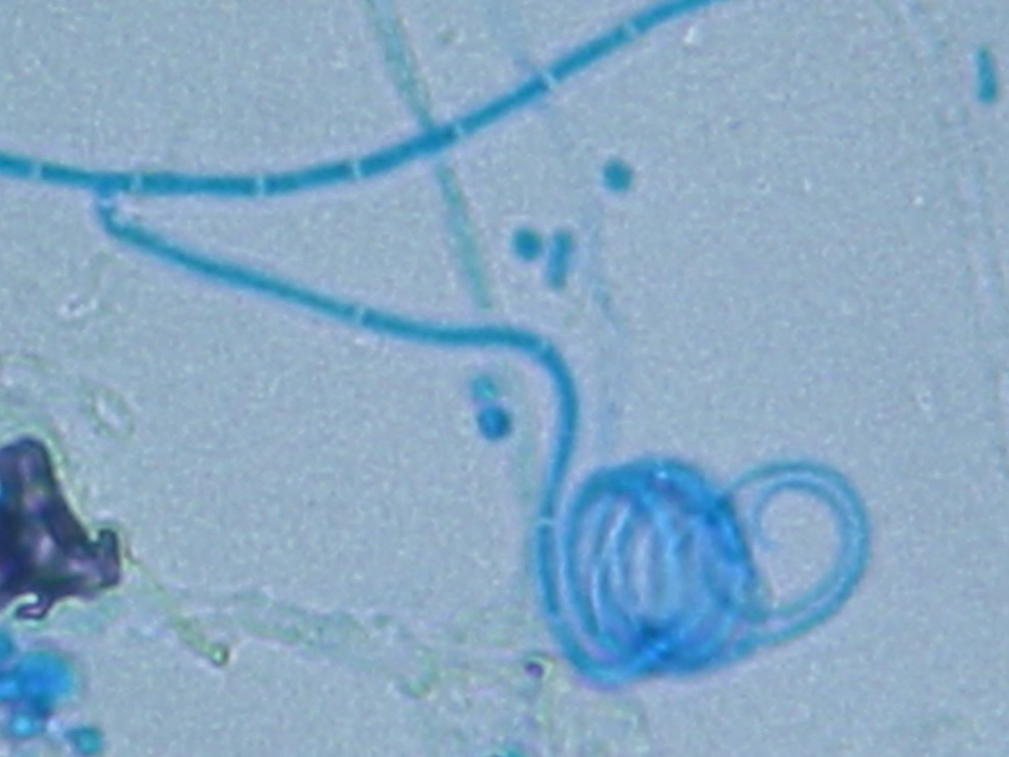 LABOPART - Trichophyton equinum