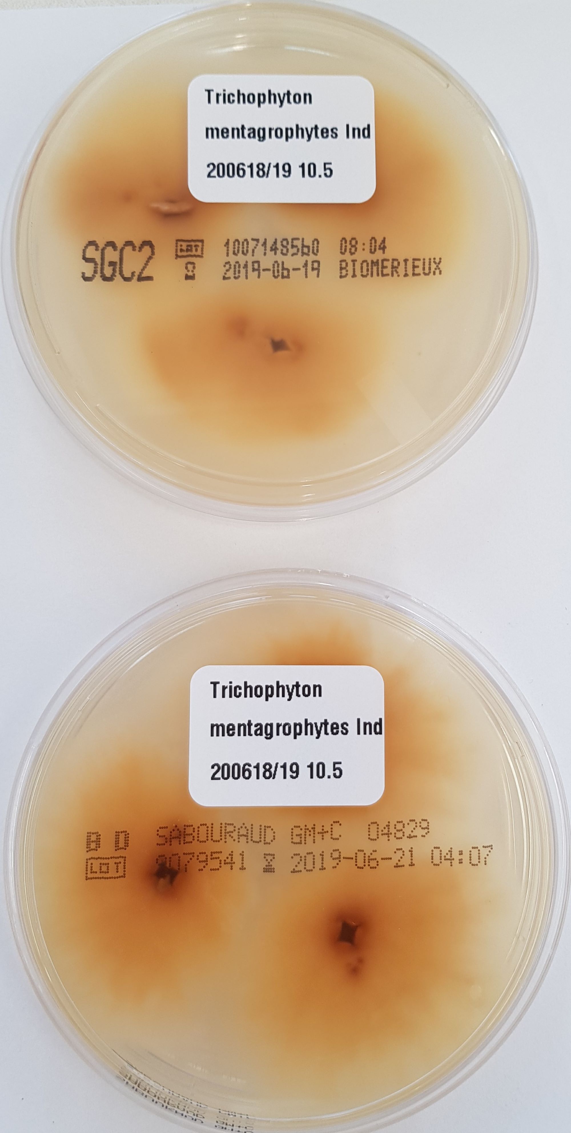 LABOPART - Trichophyton indotineae